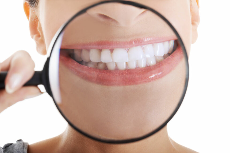 ¿Qué hago si tengo dientes astillados? - Clinica Dental Palomero