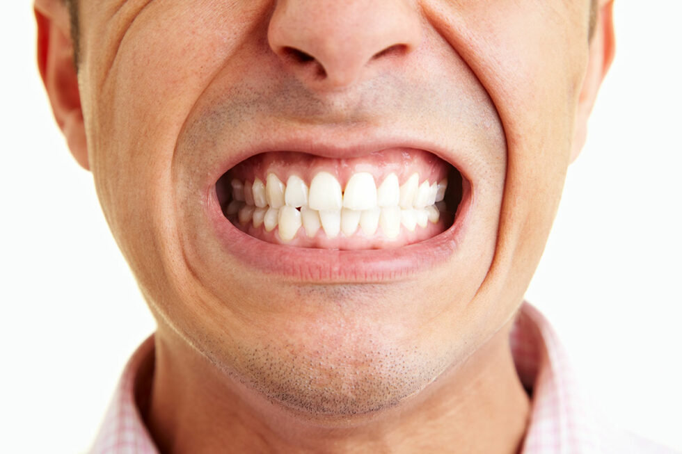 Apretar los dientes al dormir. Qué consecuencias tiene y solución